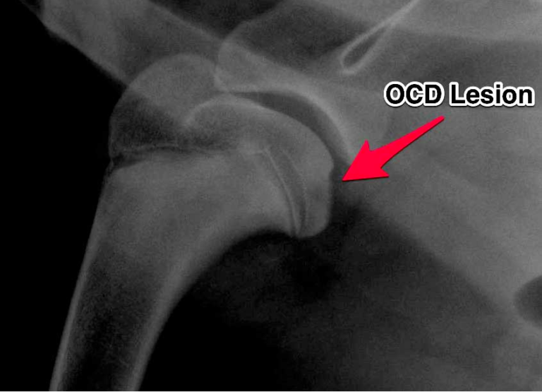 Osteocondritis disecante (OCD) en pastores alemanes - The Winter Legacy